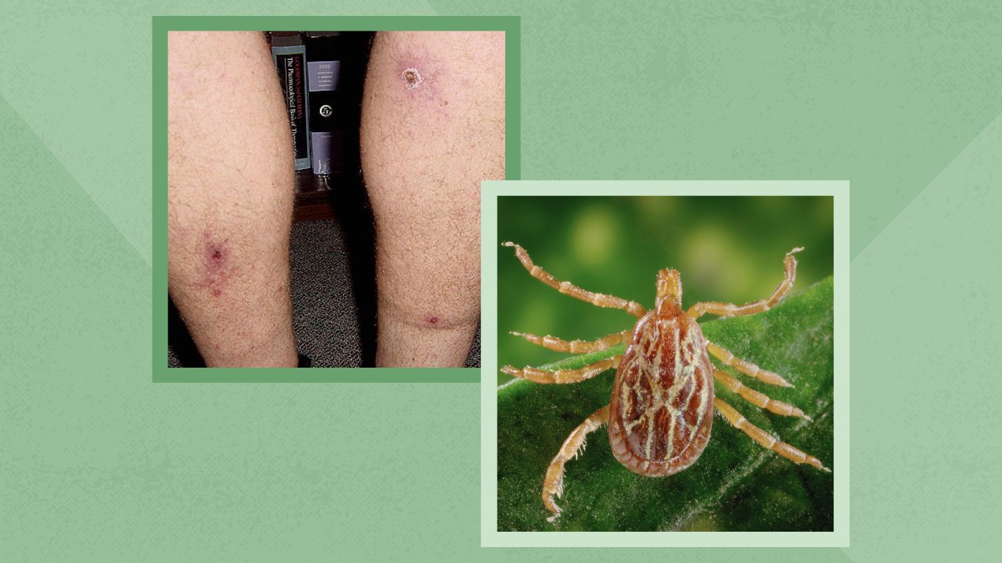 Gulf Coast Tick Vs Dog Tick : Which Tick Is More Dangerous? - Dog Show TV